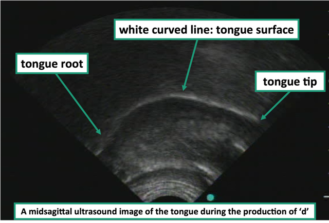 Visualizing speech production: Professor Suzy Ahn researches tongue and ...
